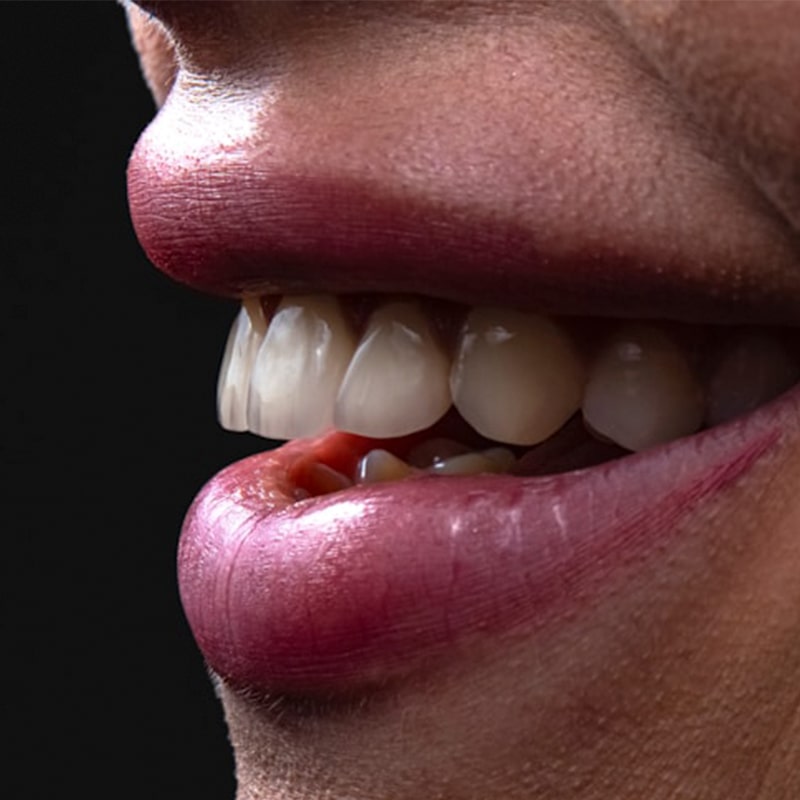 Estética Dental: Descubre el Poder de una Sonrisa Radiante. – Clinica ...